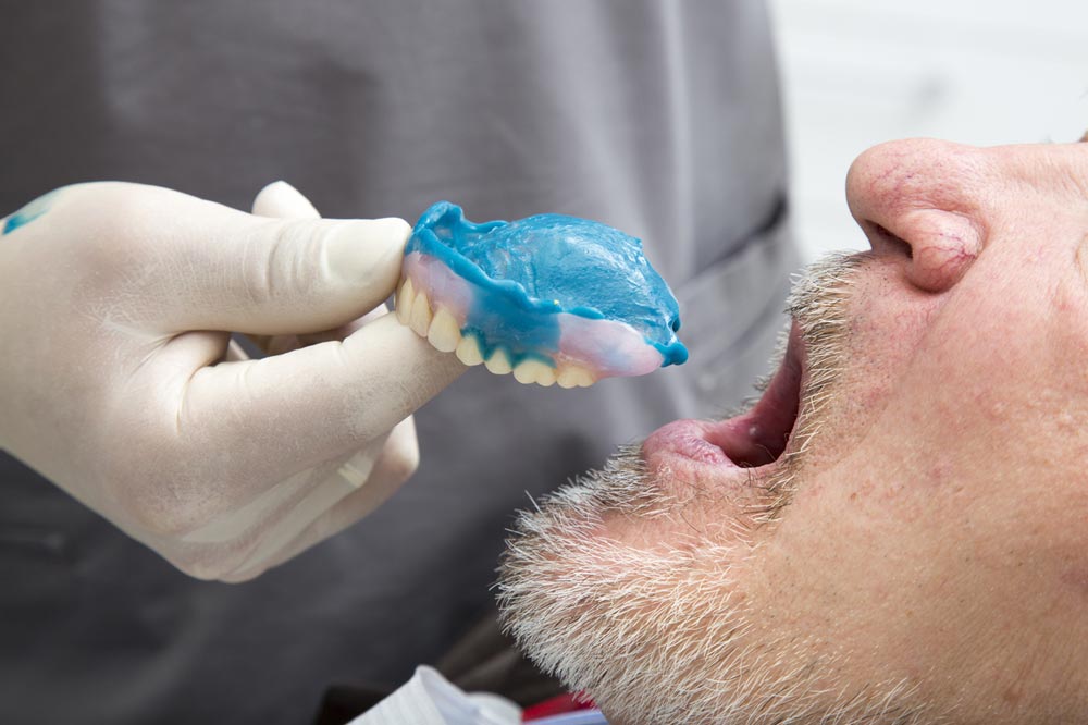 How Partial Dentures Work
