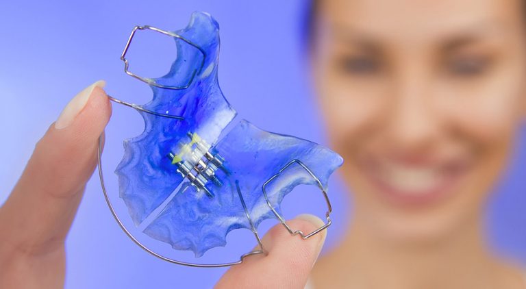 How Does a Tooth Splint Work?