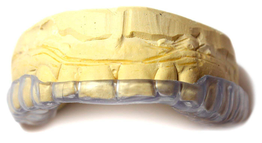 Best Sleep Apnea Mouth Guard: Our Top 5 Picks for 2018