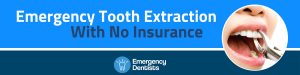 Emergency Tooth Extraction Near Me [24/7] No Insurance OK